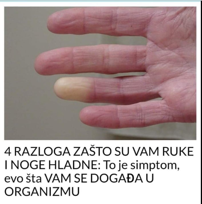 4 RAZLOGA ZAŠTO SU VAM RUKE I NOGE HLADNE: To je simptom, evo šta VAM ...