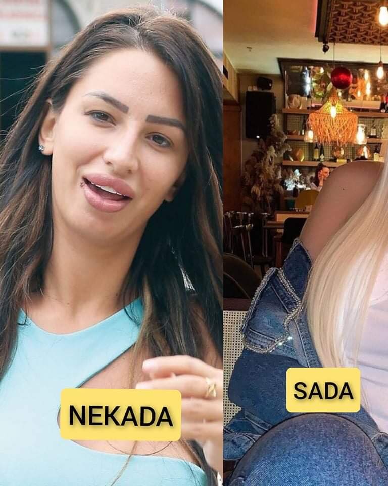 SJEĆATE SE ALEKS IZ ZADRUGE 4? URADILA ZUBE, NAPUMPALA USNE ...